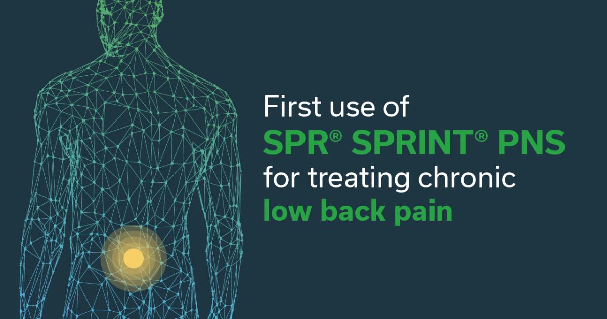 SPR announces first use of SPRINT extensa dual-lead peripheral nerve ...